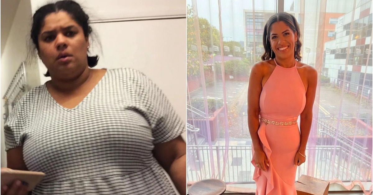 Mù một mắt do béo, người phụ nữ giảm 44kg nhờ phương pháp ăn 1:1 | Báo Dân trí